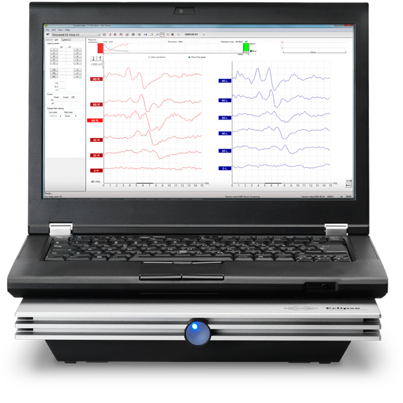 Interacoustics Eclipse EP15